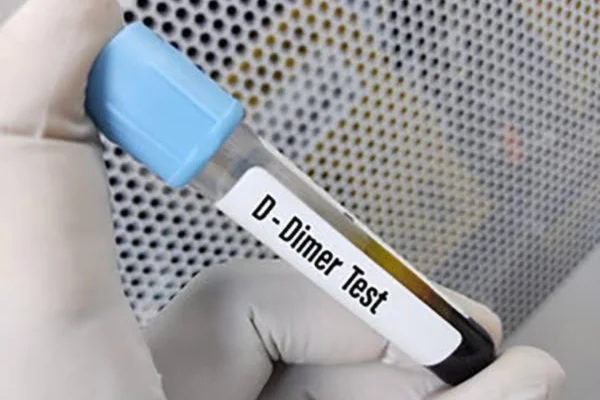 What Does A D-Dimer Test Indicate?