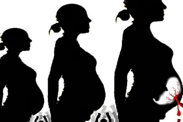 Female Foeticide: An Abberation Hard To Erase